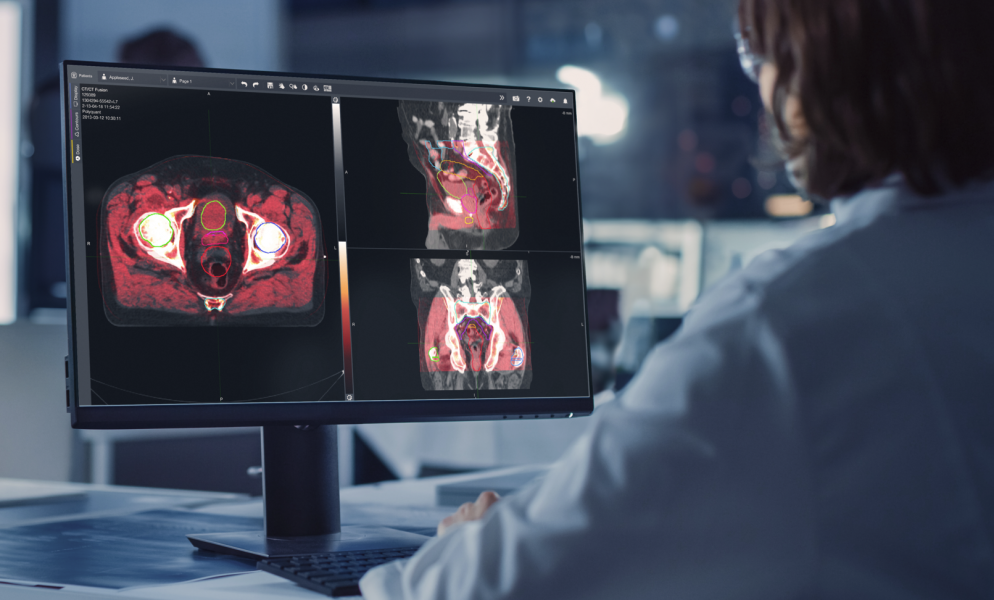 How GE Healthcare is approaching generative AI, LLMs, and ...